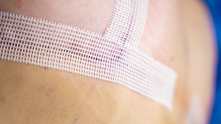 Wound Care That Really Works: Groundbreaking New Silk Surgical Dressing ...